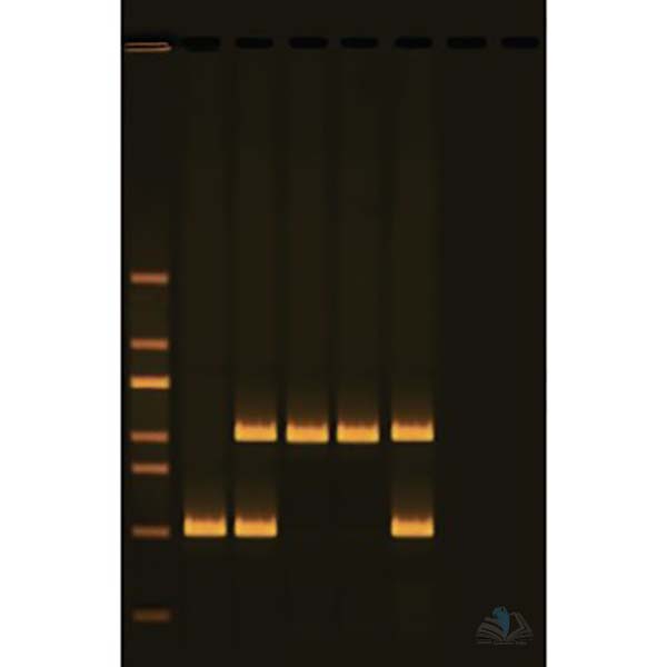 Human DNA Typing Using PCR Kit Manufacturers, Supplier & Exporters in ...